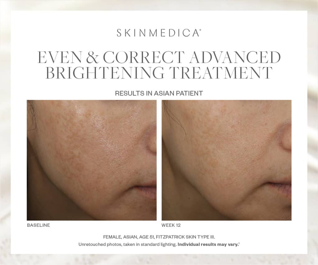 Even & Correct Advanced Brightening Treatment - Ruwanthi Campano, MD